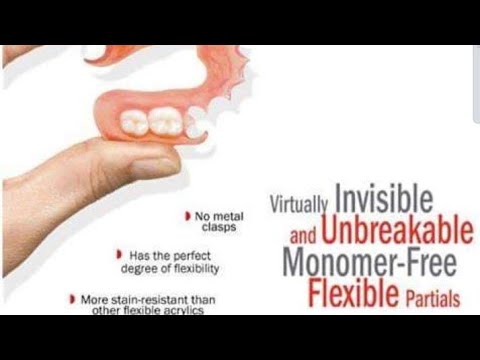 Upper and Lower Flexible Dentures, unilateral flexible dentures. - YouTube