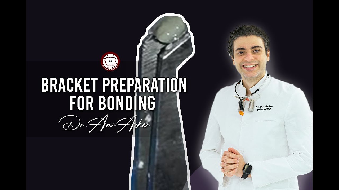 bracket preparation for bonding - YouTube
