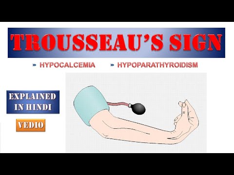 Trousseau's Sign | Hypoparathyroidism | Hypocalcemia | Practical on ...