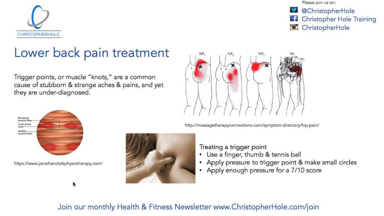 Lower back pain treatment: Trigger points - YouTube
