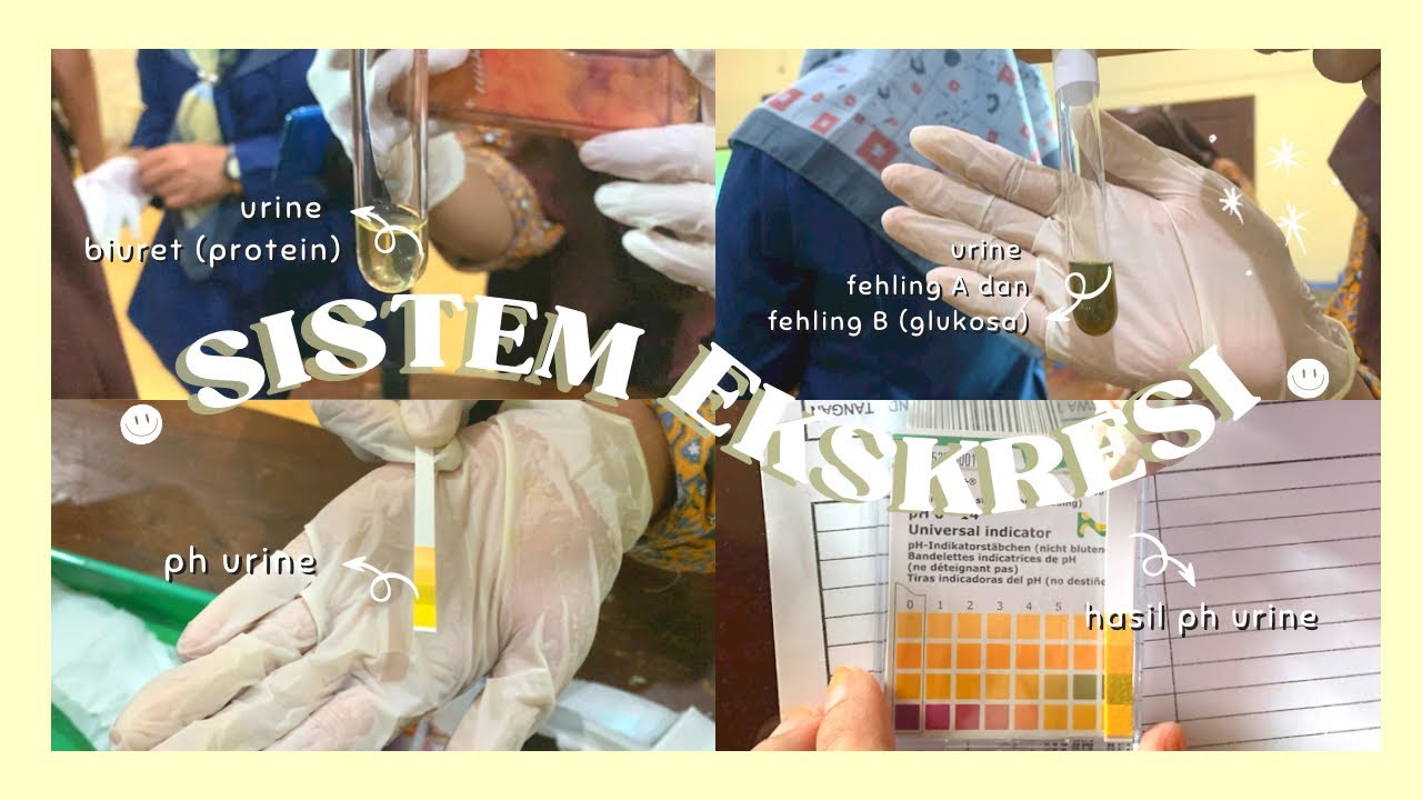 Praktikum Sistem Ekskresi || Uji Kandungan Urine || Kelompok 2 XI F3 ...