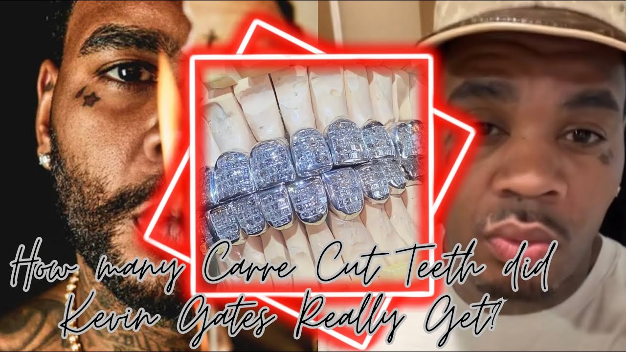 Grill Game Strong: Kevin Gates’ ICY Mouth Makeover 💎 - YouTube
