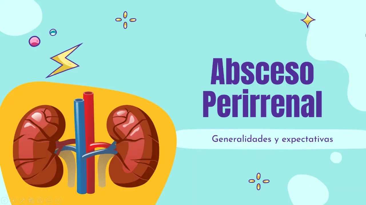 Absceso Perirrenal - YouTube
