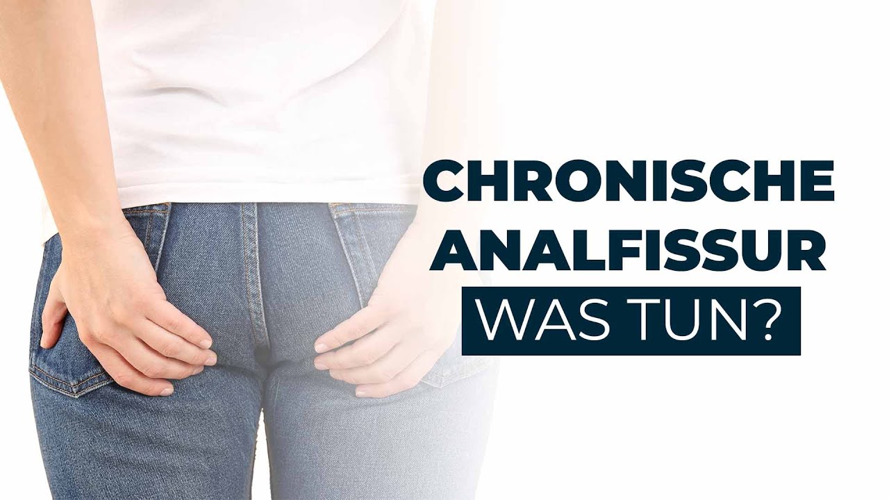 Was tun bei einer CHRONISCHEN Analfissur? Dr. Eduard Karsten klärt auf ...