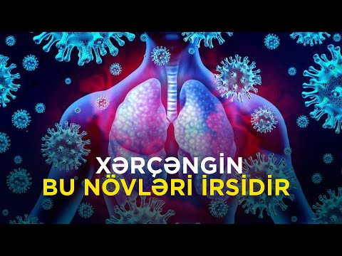 Xərçəngin irsi olduğunu bilirdinizmi?