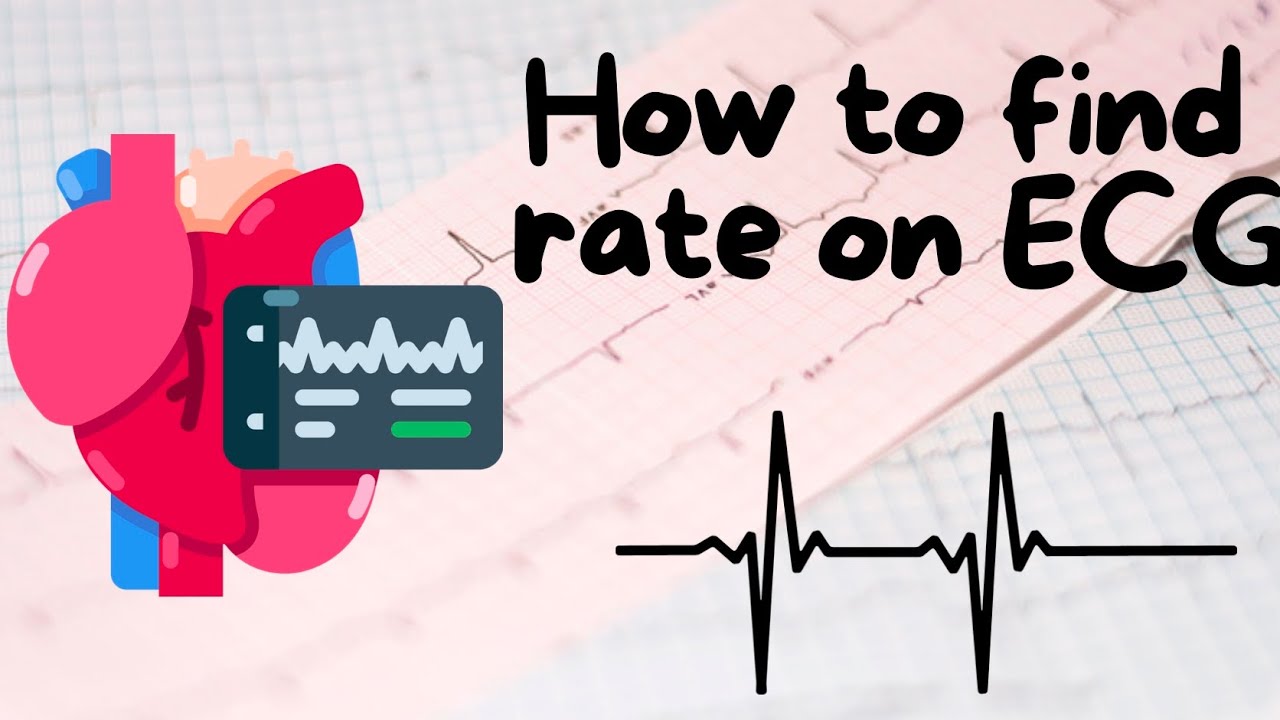 Heart Rate | How to Calculate Rate on ECG | Simple Steps for Accurate ...