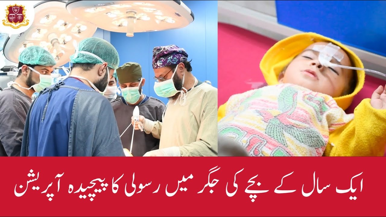 1-year-old-baby | Hepatoblastoma Surgery | Peads | Dr. Muhammad Imran ...