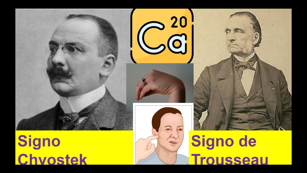 Los Signos de Chvostek y Trousseau - YouTube
