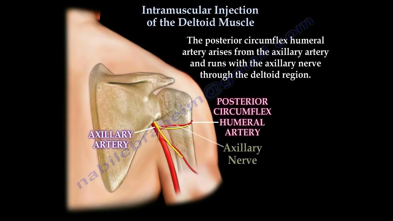 Intramuscular injection of the deltoid muscle, immunization, deltoid muscle anatomy - YouTube