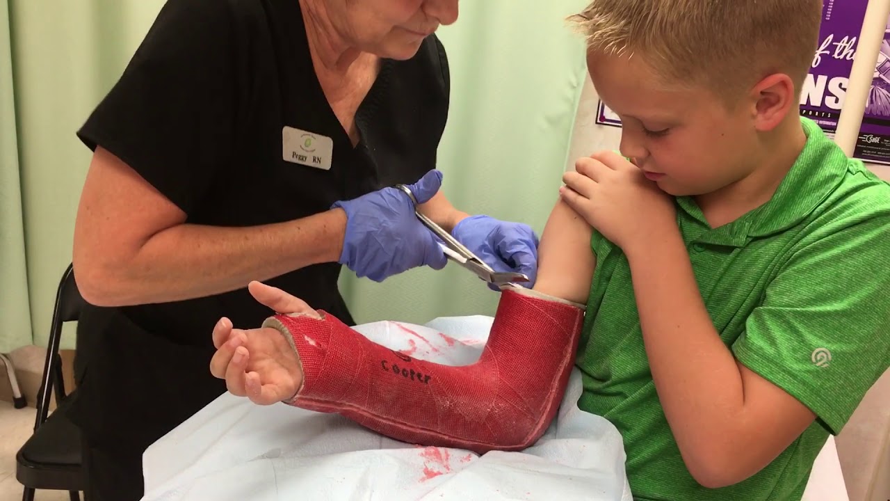 Getting my cast off - YouTube