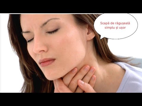 Cum sa scap de raguseala? - YouTube