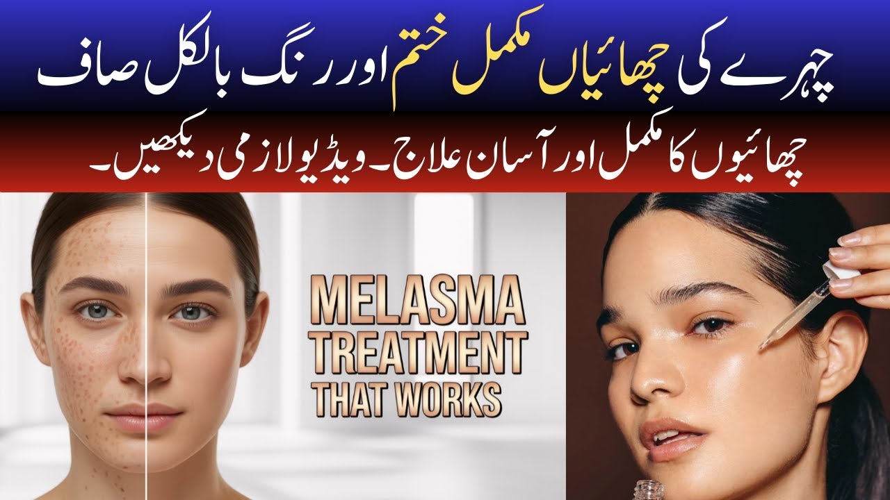 5 Simple Tricks to Instantly Improve Your Hyperpigmentation - YouTube