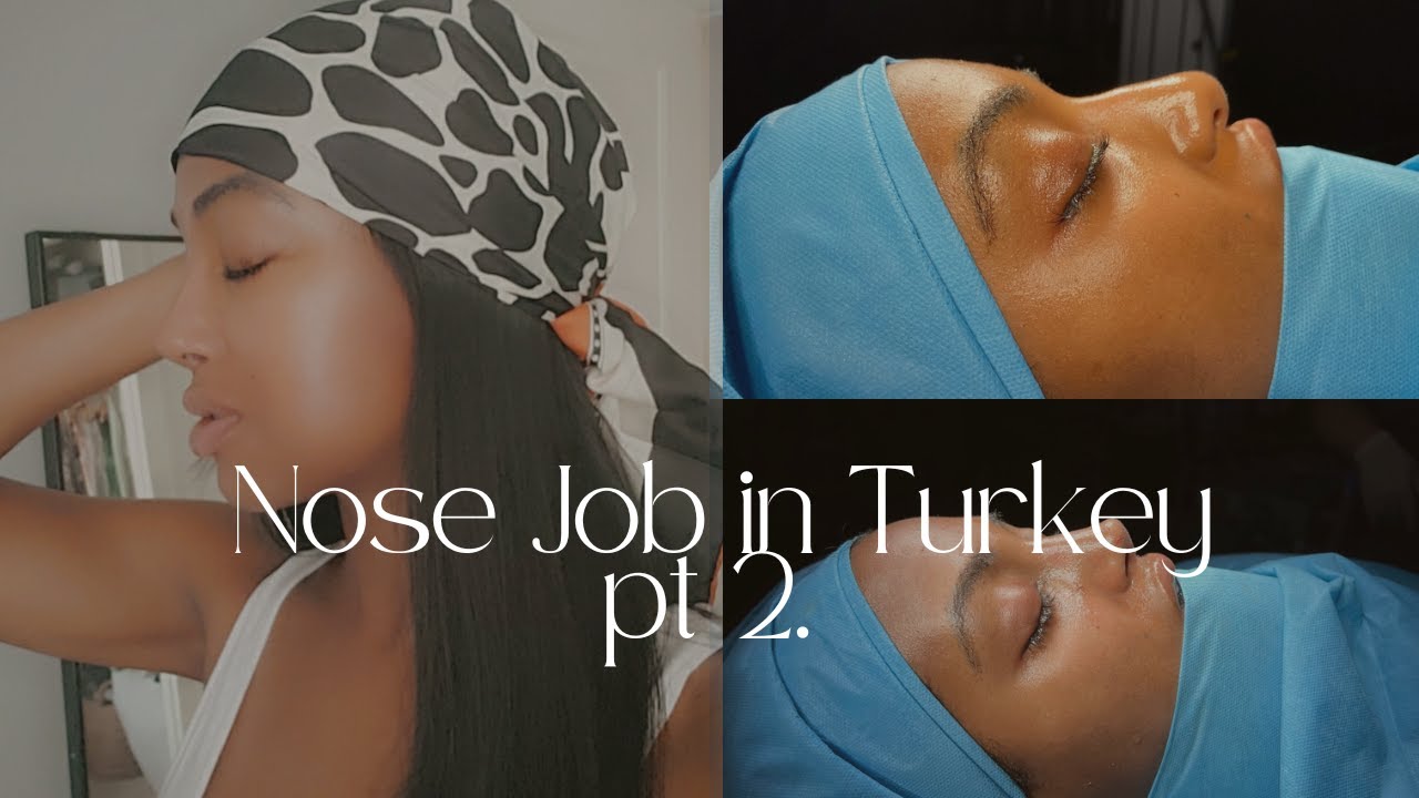 Rhinoplasty in Istanbul Turkey - Finest Clinic - YouTube