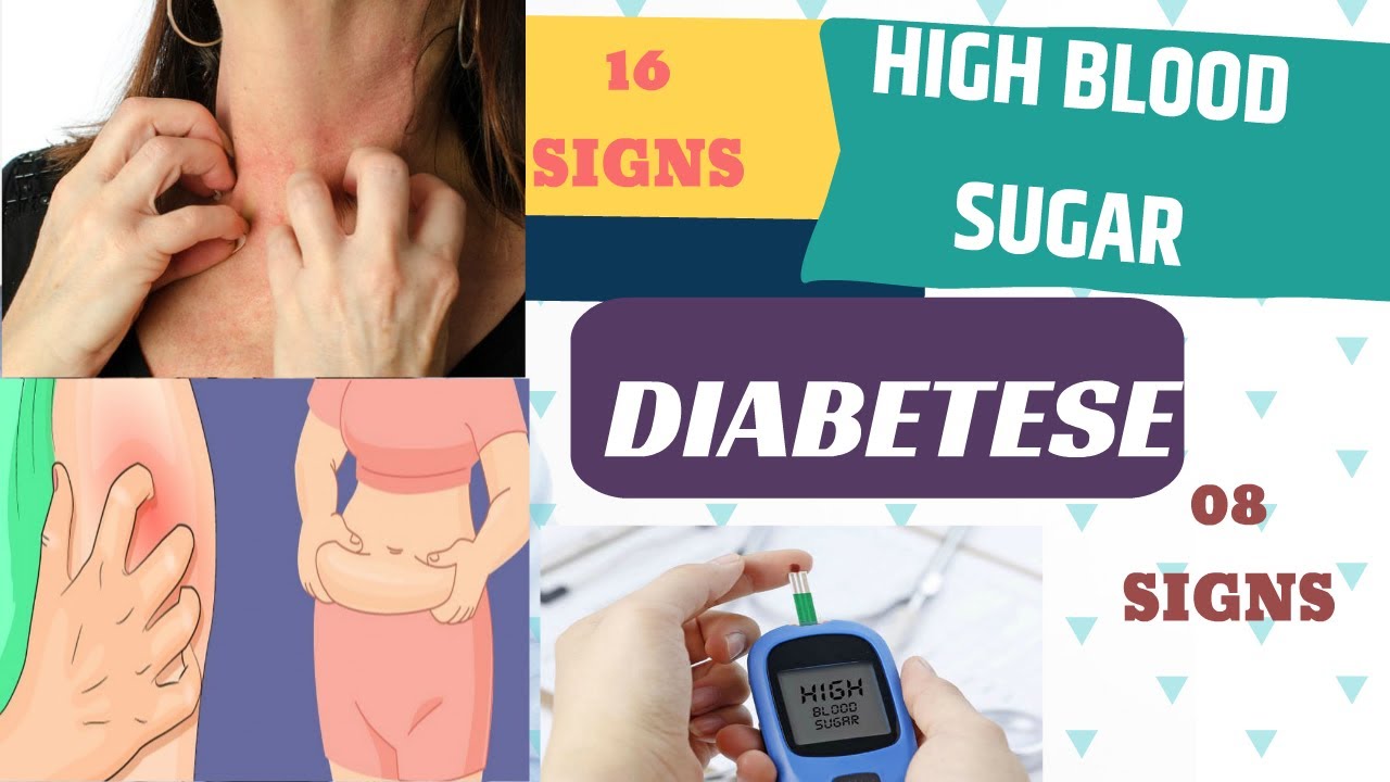 16 SIGNS AND SYMPTOMS THAT YOU HAVE HIGH BLOOD SUGAR AND 8 SIGNS AND 16 SIGNS AND SYMPTOMS THAT YOU HAVE HIGH BLOOD SUGAR AND 8 SIGNS AND