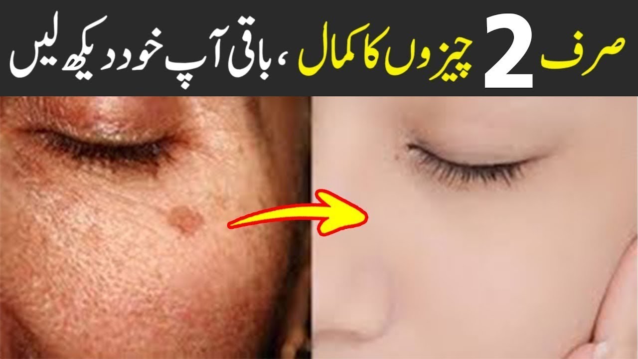 SKIN WHITENING With Easy Recipe, A Magic Remedy for Pigmentation ...