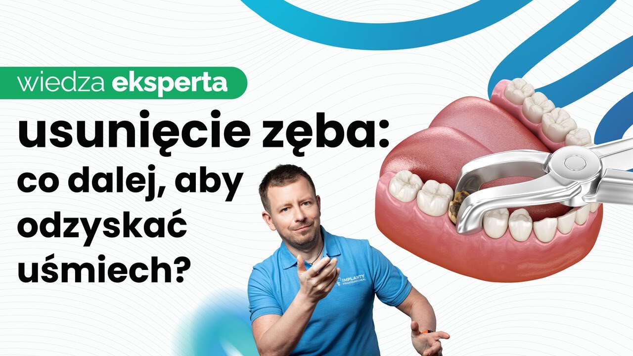 IMPLANTACJA NATYCHMIASTOWA BEZBOLESNE USUWANIE ZĘBÓW I WSZCZEPIENIE ...