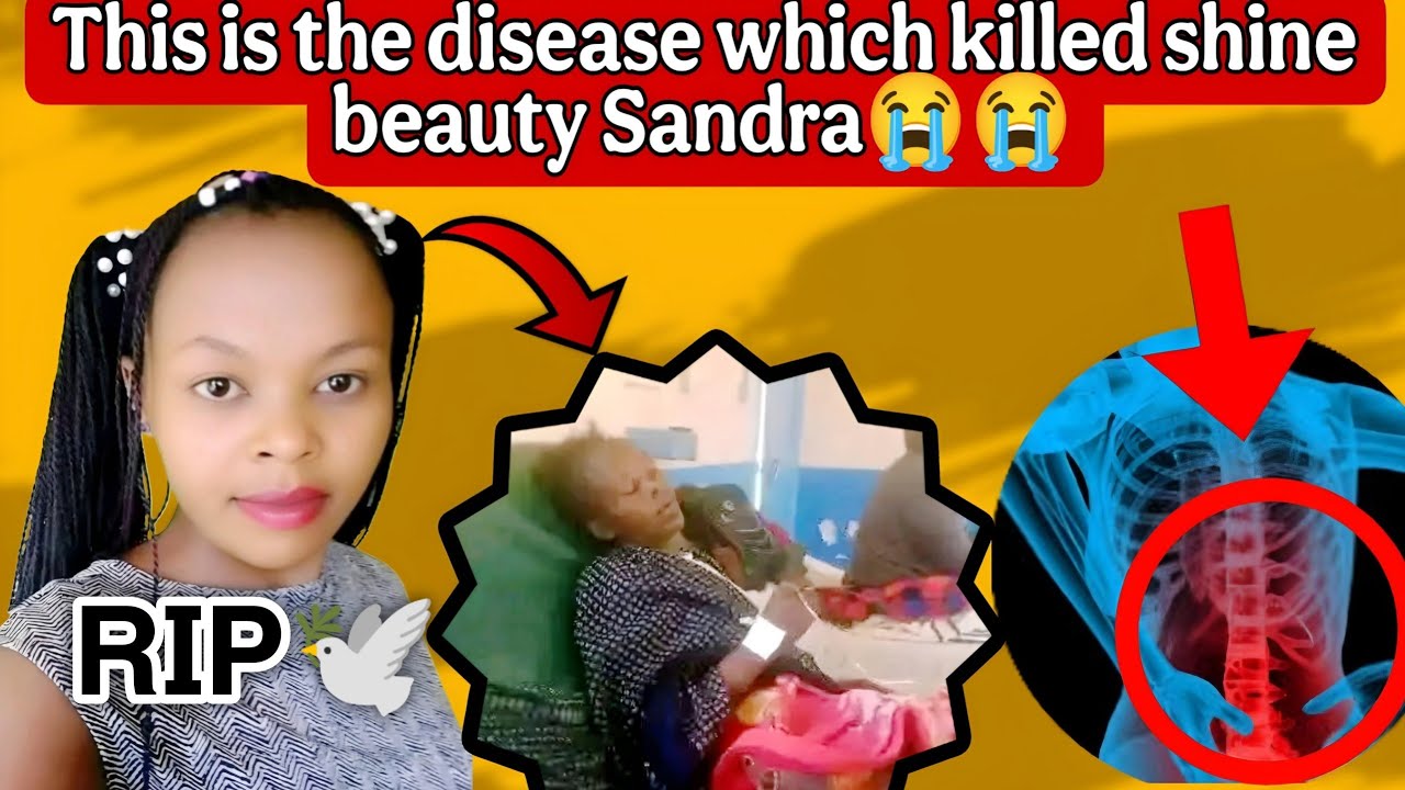 Last words of SHINE BEAUTY SANDRA before death😭😭"she died of"SPINE ...