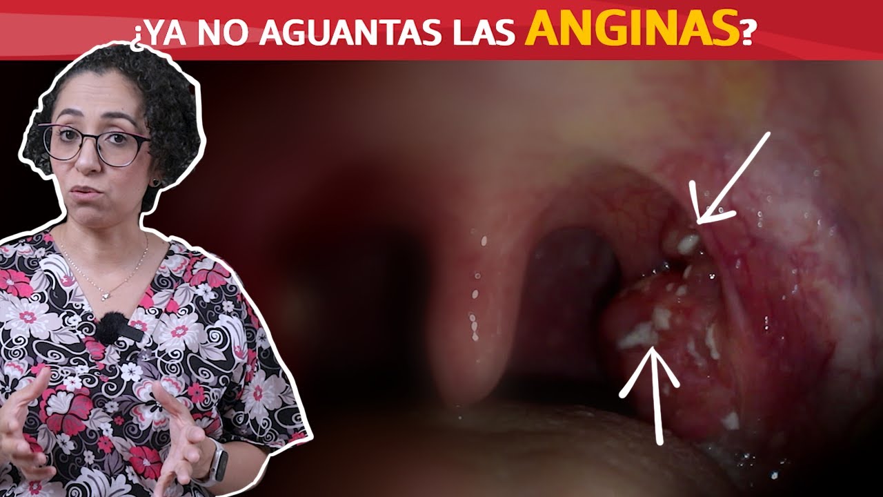 ¿YA NO AGUANTAS LAS ANGINAS Y TE ESTÁS ENFERMANDO A CADA RATO? ¡Aquí te ...