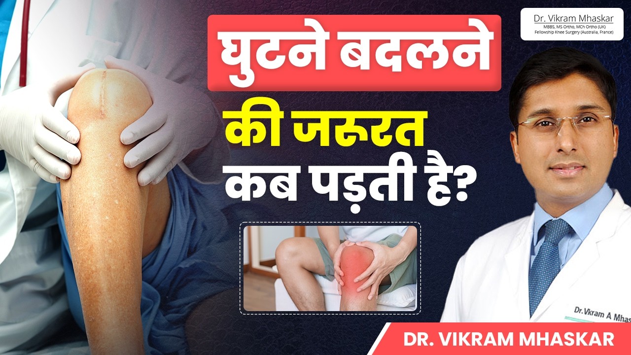 Knee Replacement कब करवाना चाहिए ? | Knee Pain का Permanent इलाज | Dr ...
