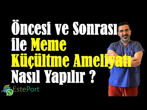 Öncesi ve Sonrası ile Meme Küçültme Ameliyatı Nasıl Yapılır ?
