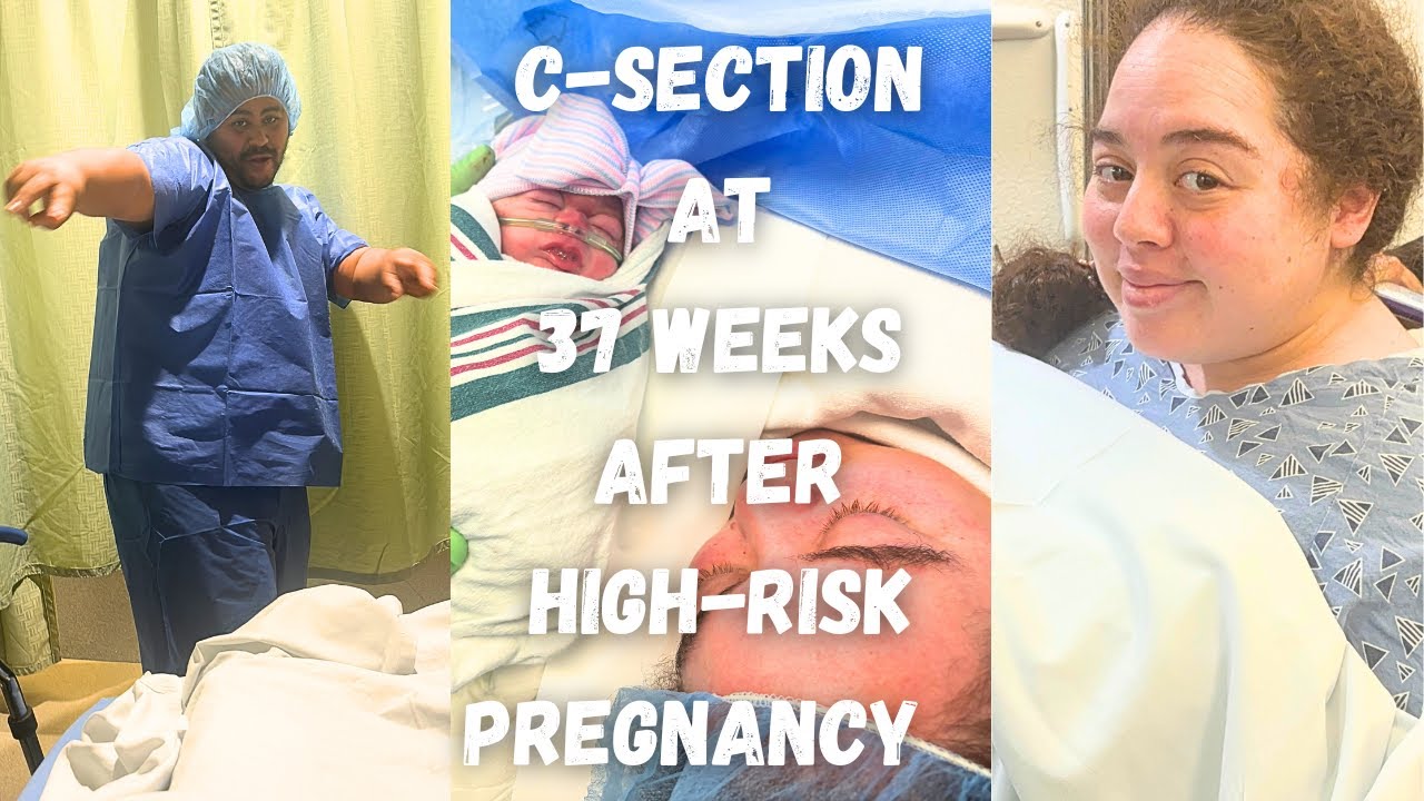 Repeat C-Section at 37 weeks After High-Risk Pregnancy and prior Fetal ...