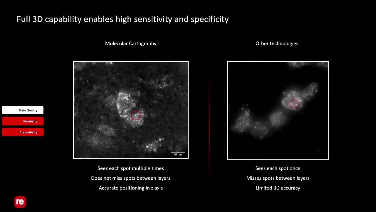 Identifying Disease Signatures In Situ Using Highly Sensitive Spatial Transcriptomics - YouTube