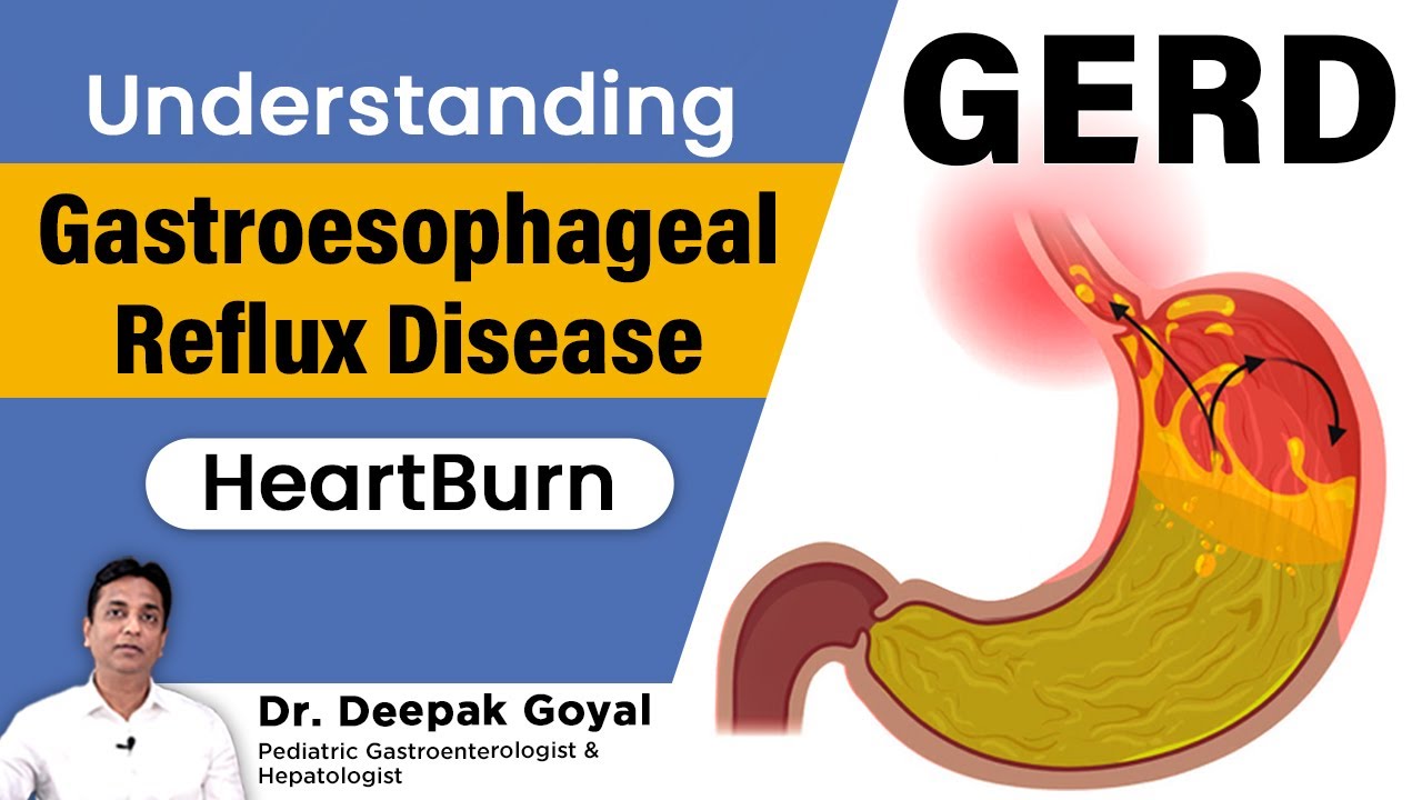 क्या आप Gastric Reflux से परेशान हैं ||Know everything about Reflux ...