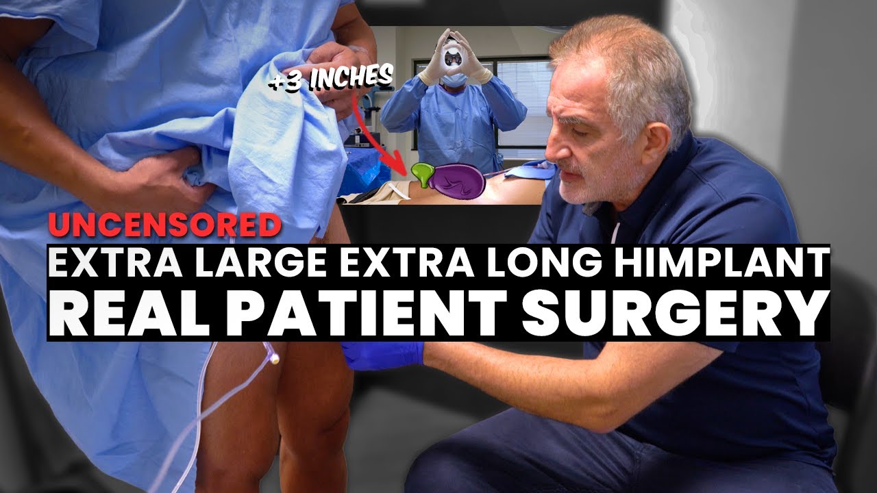 Penuma Surgery Before And After