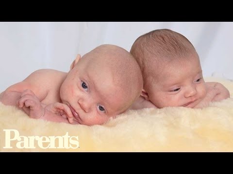 Birth Stories When You're Expecting Twins | Parents