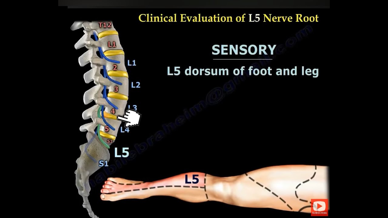 NERVE INJURIES OF THE LOWER EXTREMITY. Foot drop, tarsal tunnel ...