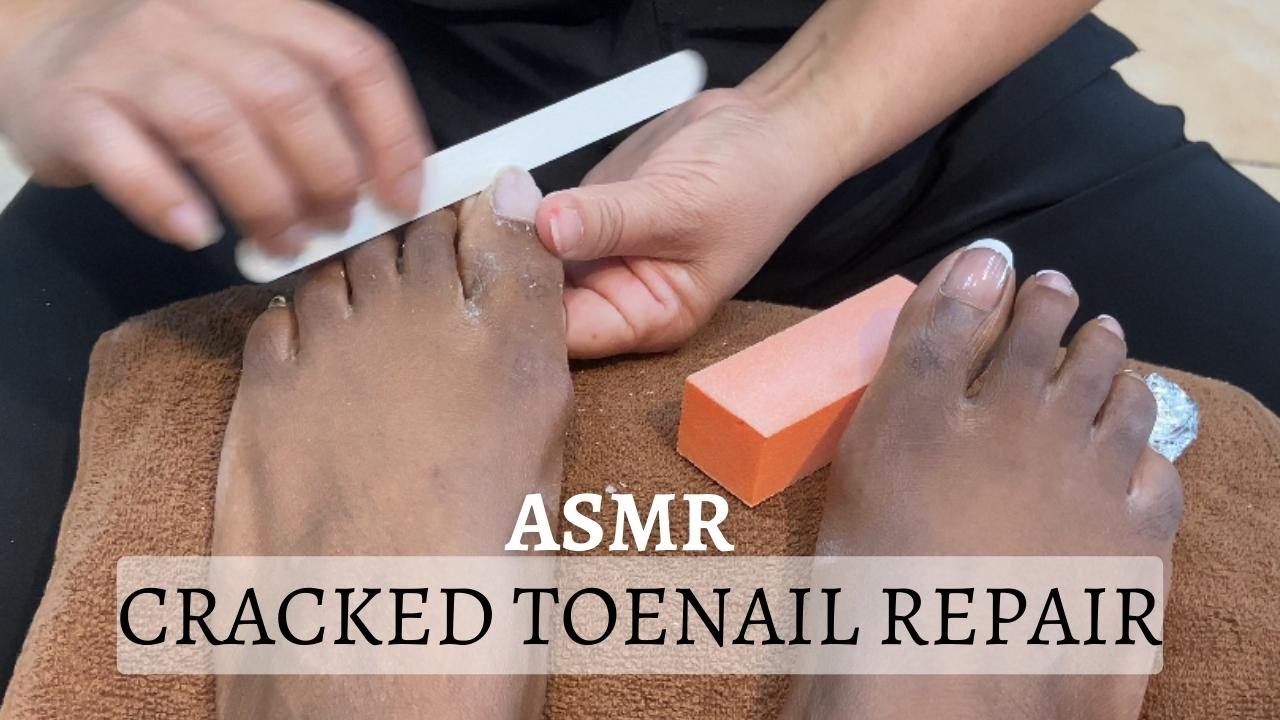 ASMR Cracked Toenail Repair | Pedicure ASMR - YouTube