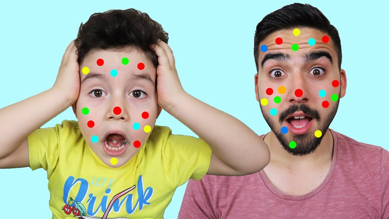 Yusuf and Uncle funny story about big pimple | Komik Sivilceler - YouTube