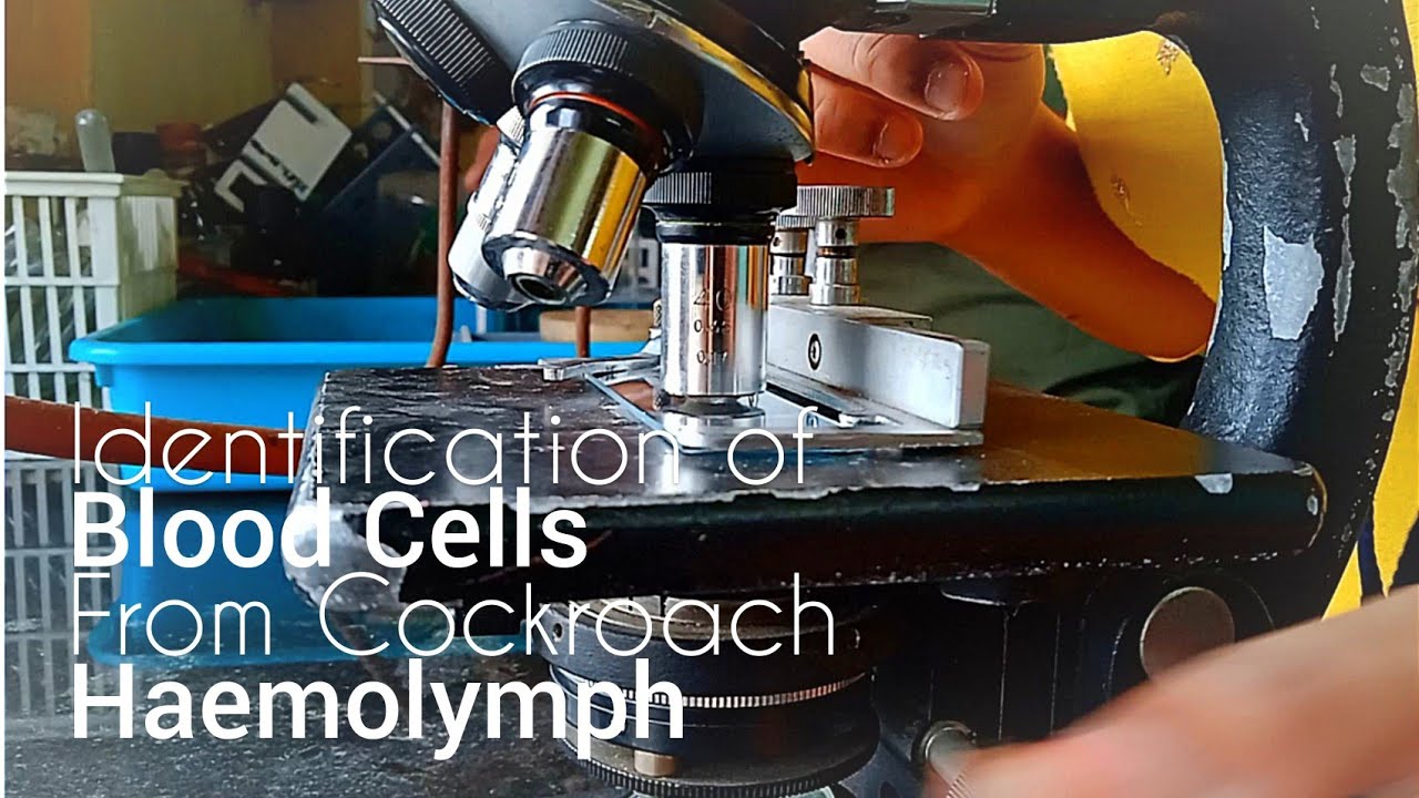 Identification of Blood Cells from Cockroach Haemolymph (Practical ...
