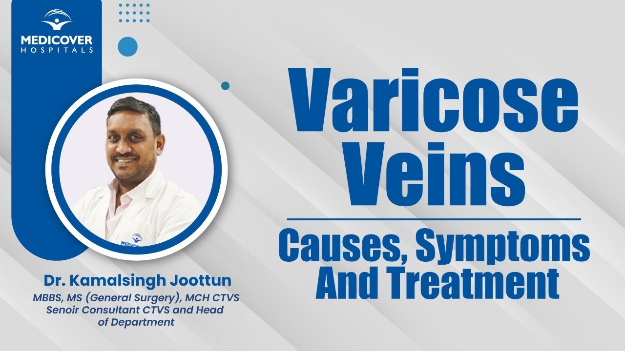 Varicose Veins: Causes, Symptoms And Treatment | Medicover Hospitals ...