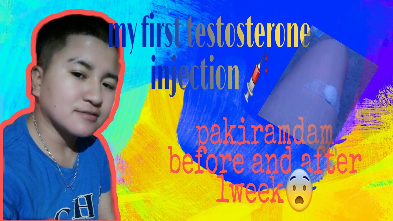 ftm/my first testosterone injection and after 1week😍/trans pinoy - YouTube