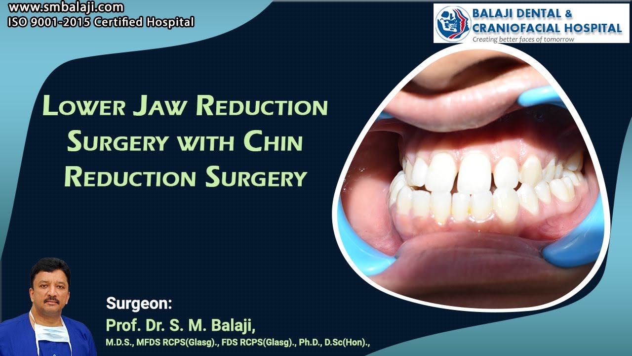 Lower Jaw Reduction Surgery with Chin Reduction Surgery - YouTube