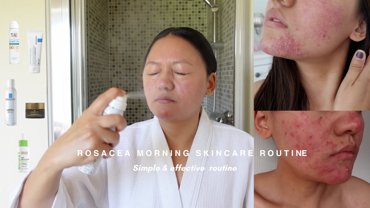 Rosacea morning skincare routine⎜Simple & effective 5 products only ...