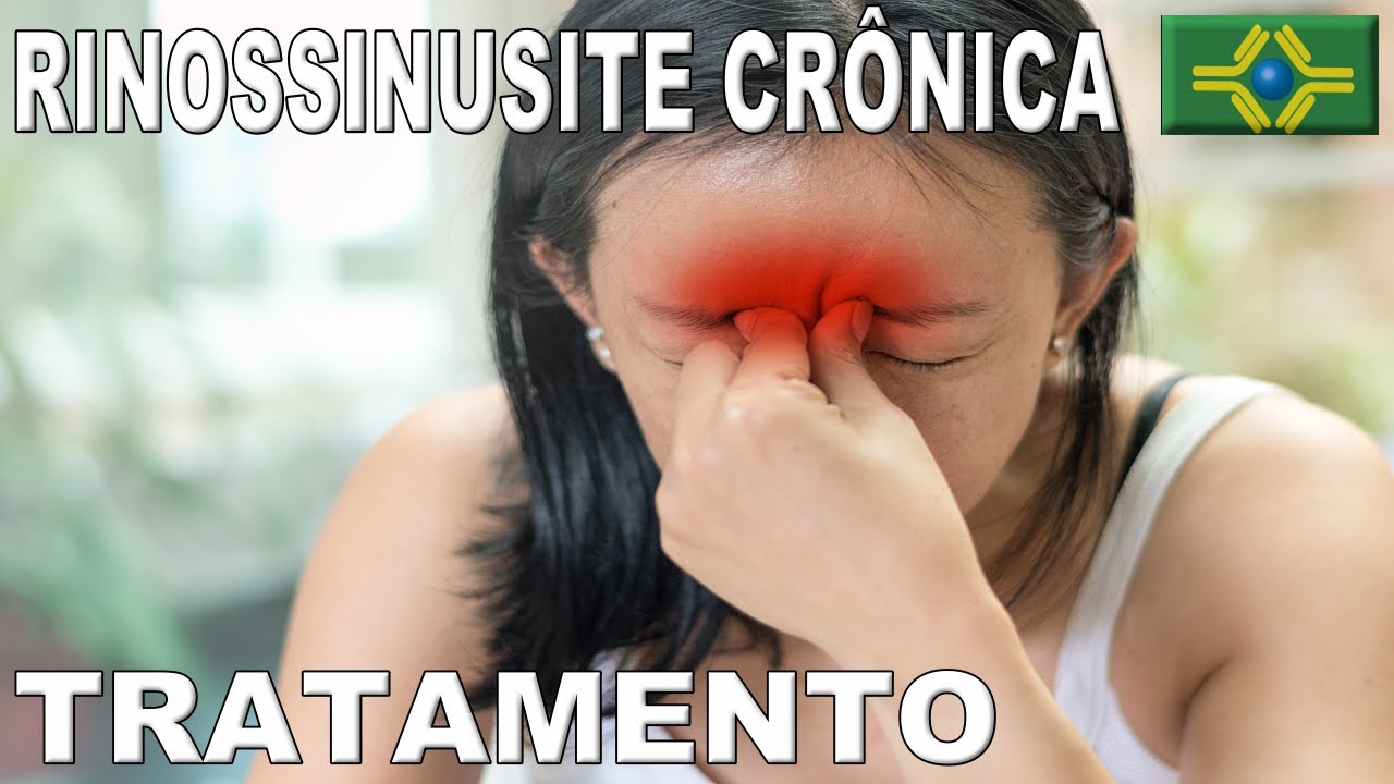RINOSSINUSITE CRÔNICA | Qual o TRATAMENTO? - YouTube