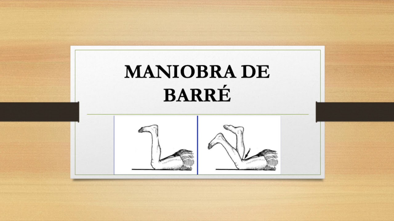 MOTILIDAD ACTIVA VOLUNTARIA: MANIOBRA DE MINGAZZINI, DE BARRÉ Y ...