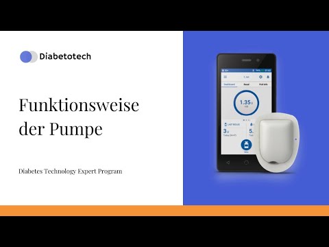 Omnipod DASH | Funktionsweise der Pumpe | Diabetotech