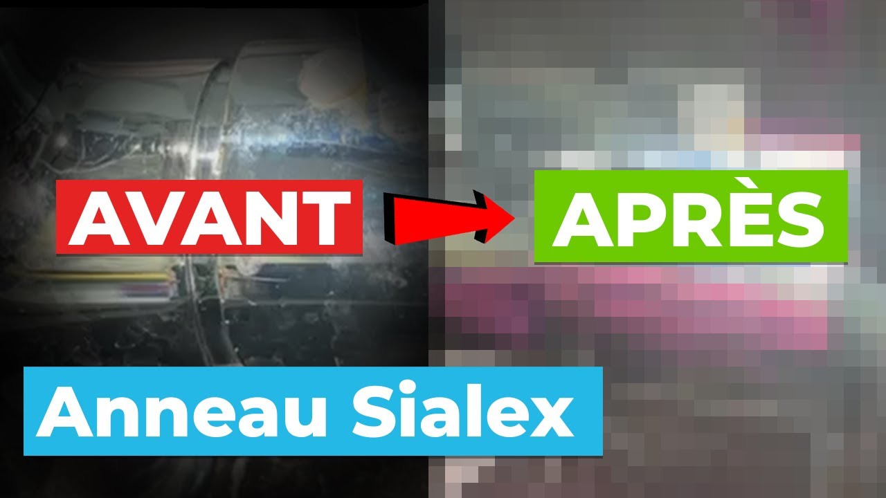 Sialex®Ring : Avis d'un client & Résultats AVANT / APRÈS - YouTube