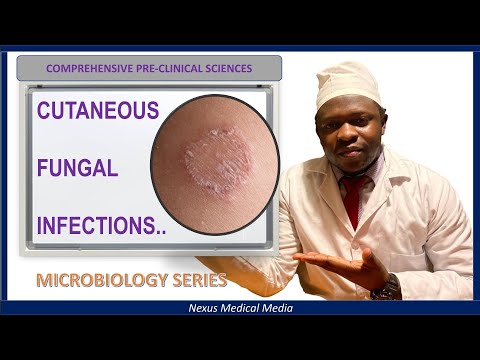 CUTANEOUS FUNGAL INFECTIONS |Dermatophytoses - YouTube