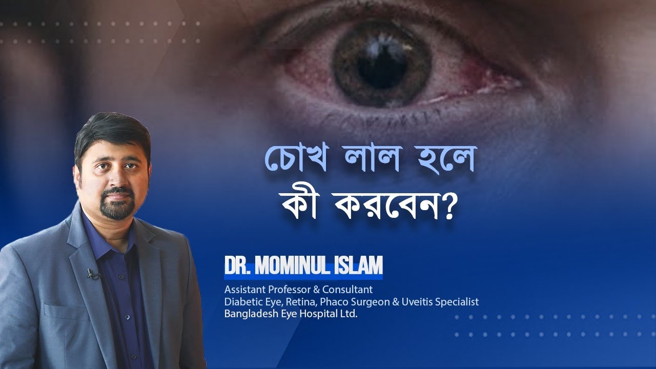 চোখ লাল হলে করনীয়।। Dr. Mominul Islam - YouTube