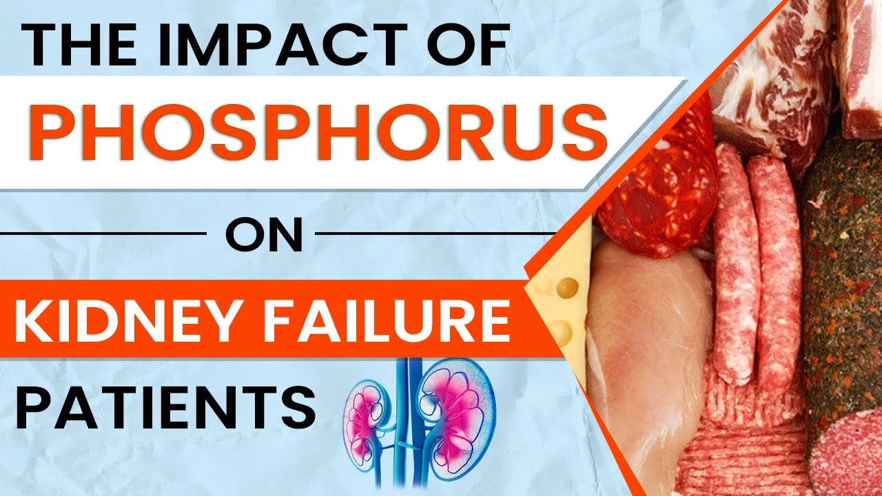 The Impact Of Phosphorus On Kidney Failure Patients. - YouTube