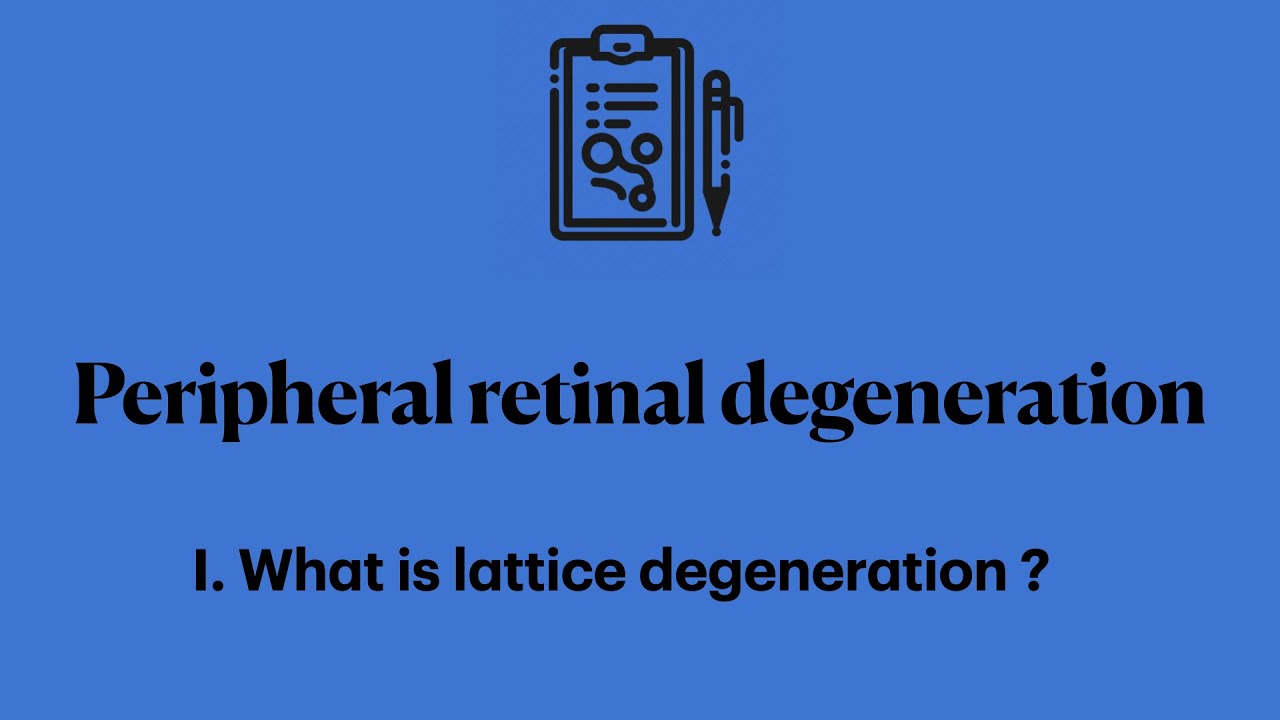 Peripheral retinal degeneration. I. what is lattice degeneration - YouTube