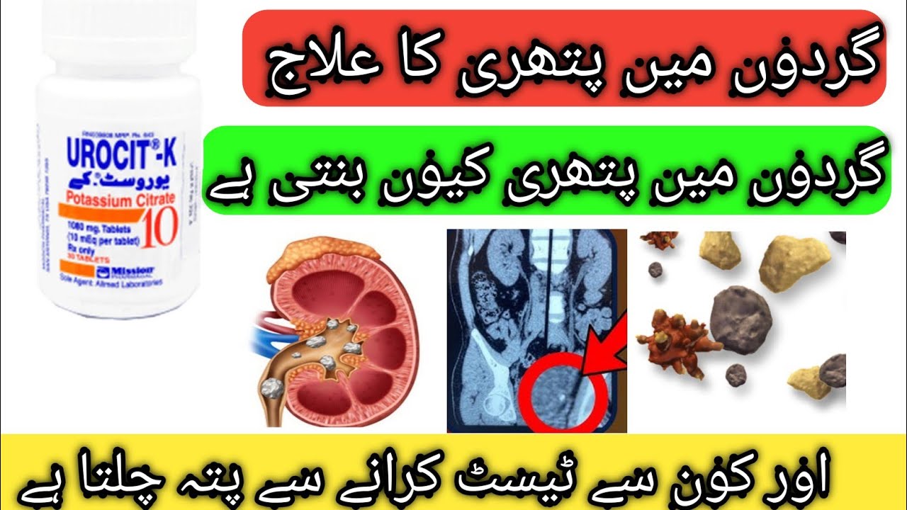 urocit k tablet benefits for kidney stone patient in urdu/dosage/ side ...