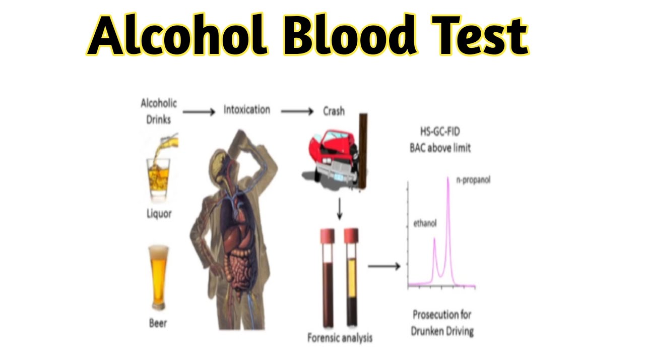 Alcohol Test Alcohol Blood Test YouTube