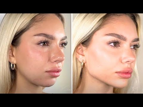experimental facial sculpting and definition — 1X MAX!