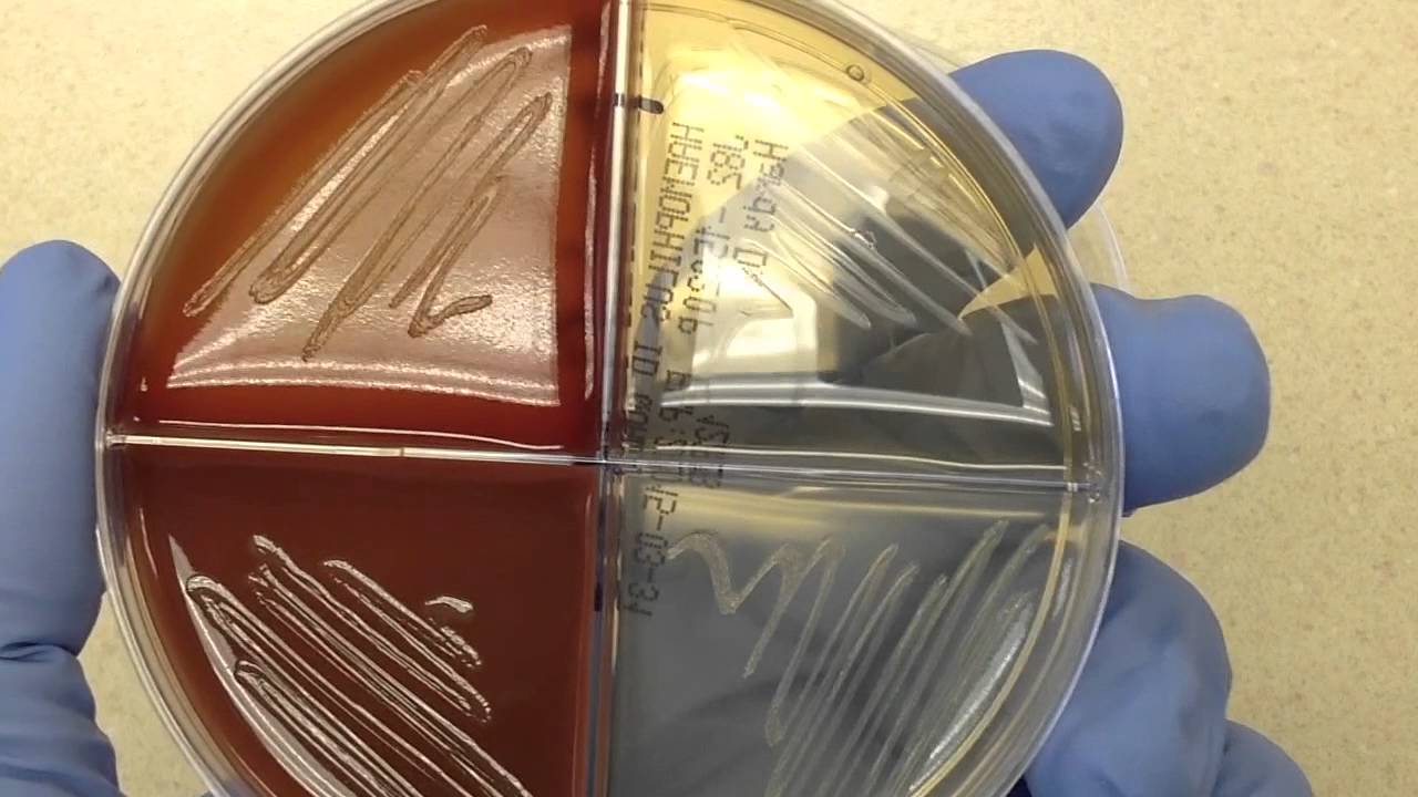 Mirobiology - Quad Plate - YouTube