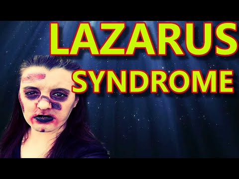 Lazarus Syndrome People RAISE from the DEAD